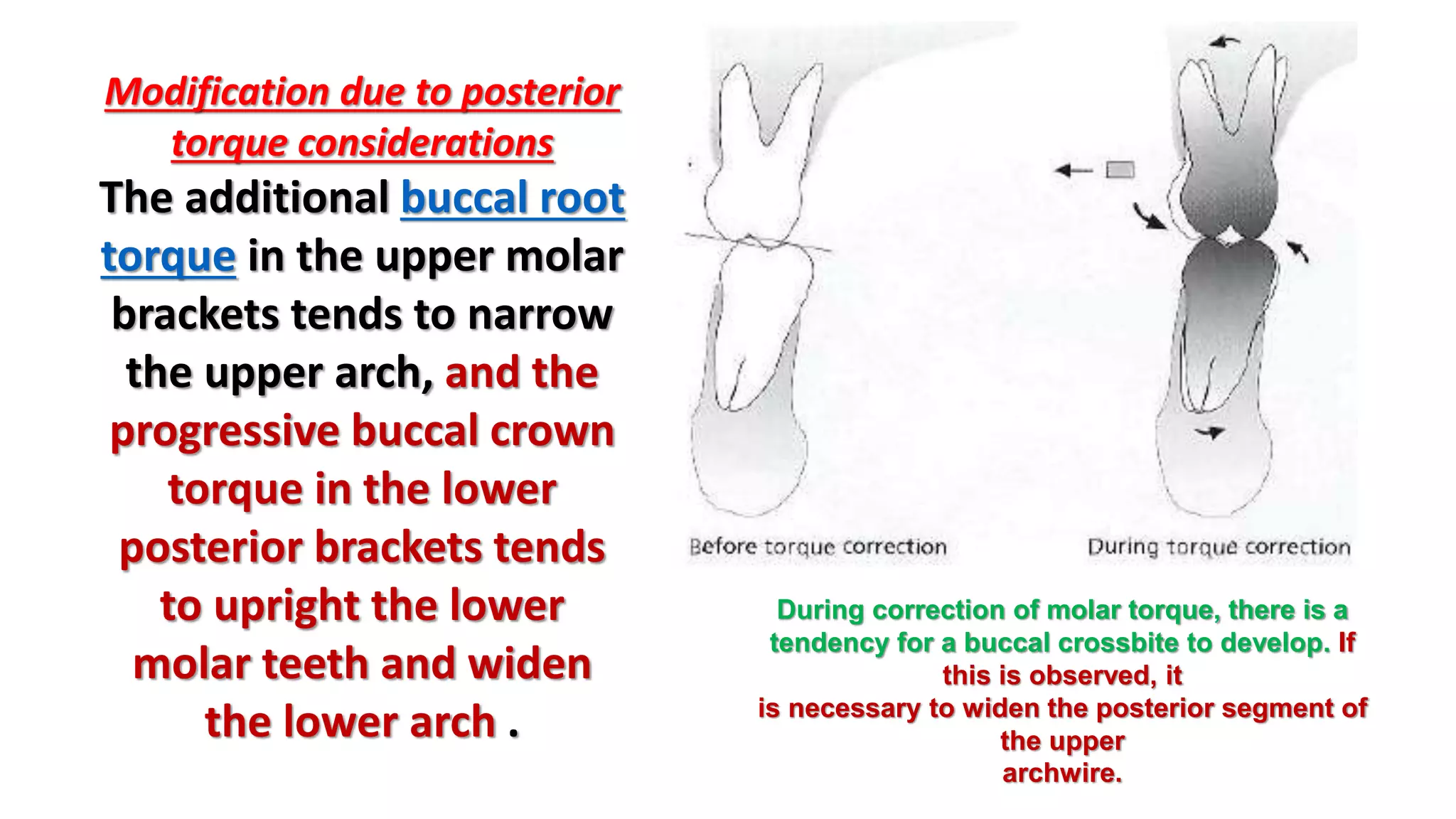 orthodontic arch form | PPTX