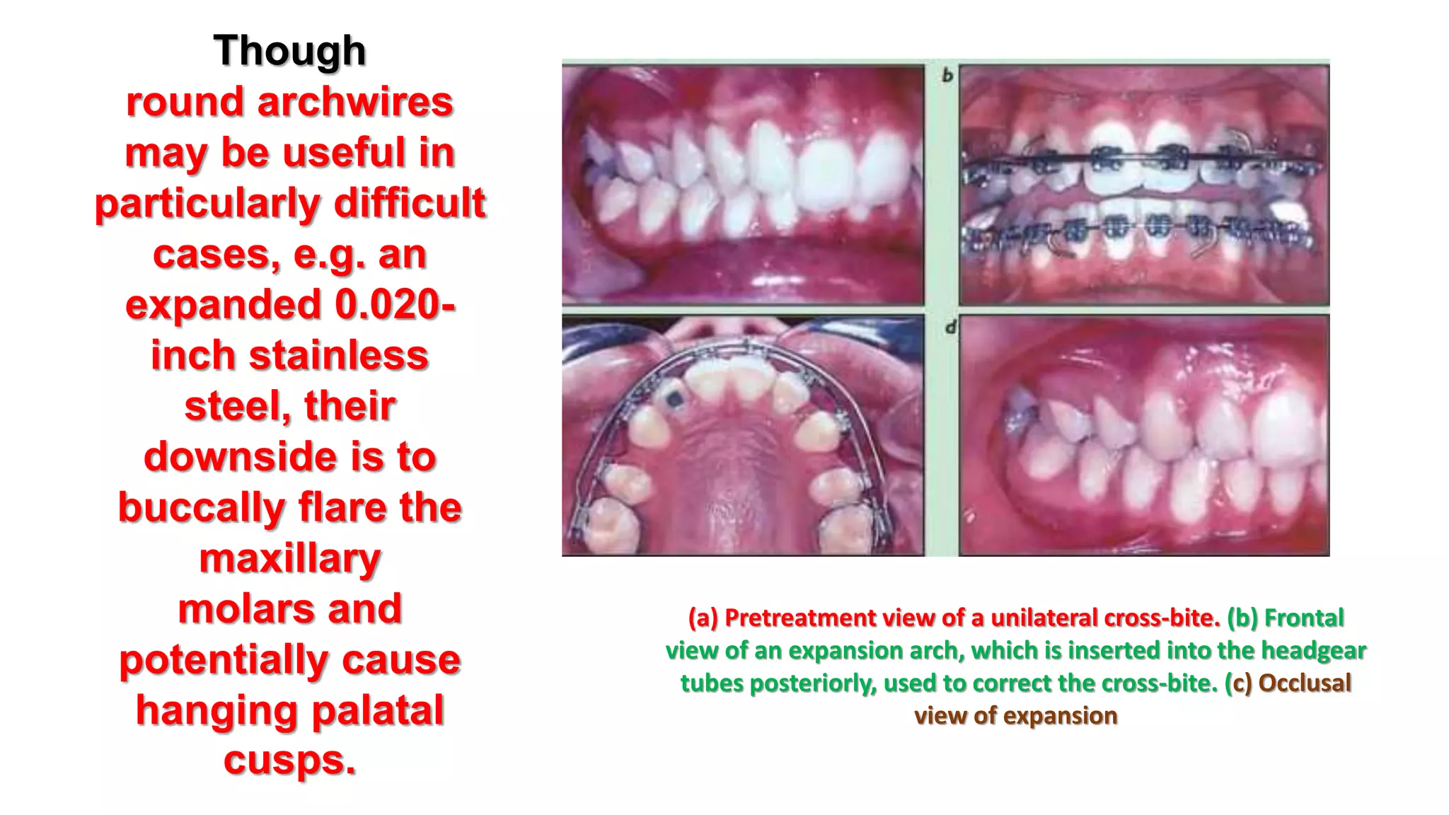 orthodontic arch form | PPTX