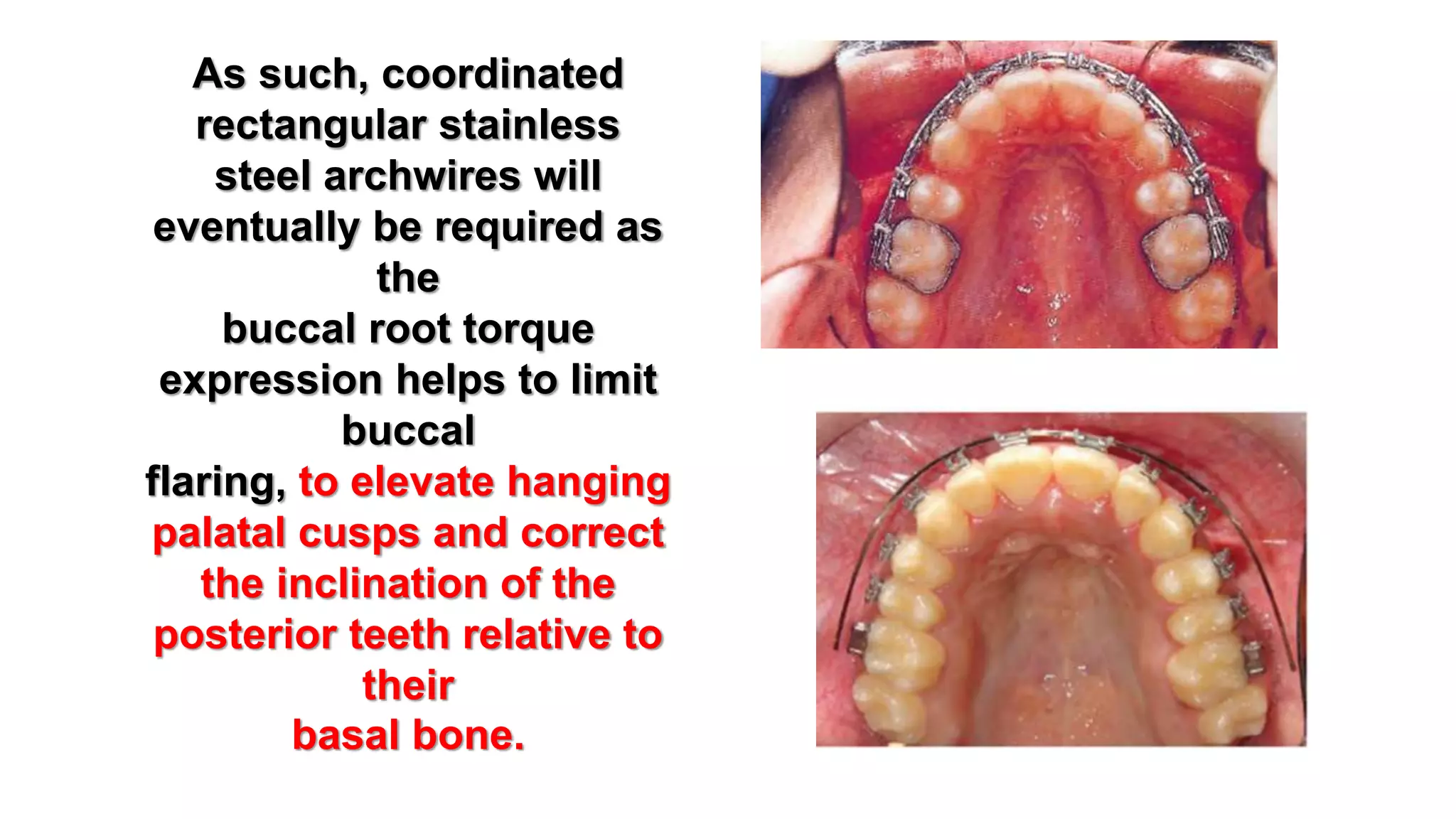 orthodontic arch form | PPTX