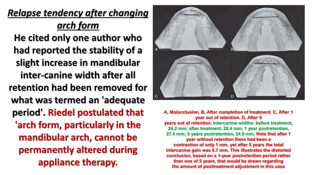 orthodontic arch form | PPTX | Dental Health | Diseases and Conditions