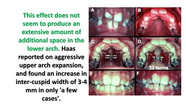 orthodontic arch form | PPTX | Dental Health | Diseases and Conditions