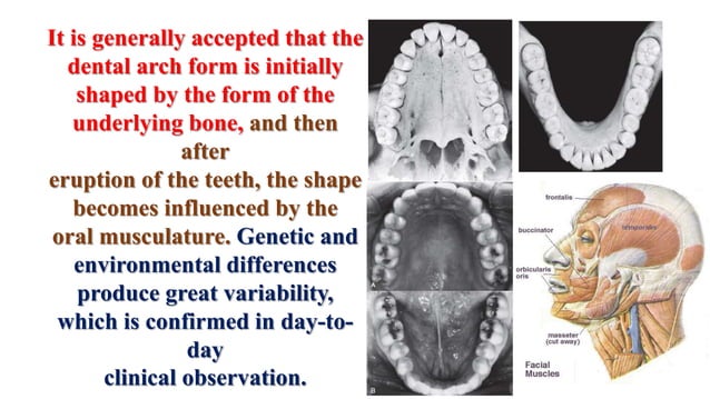 orthodontic arch form | PPTX | Dental Health | Diseases and Conditions