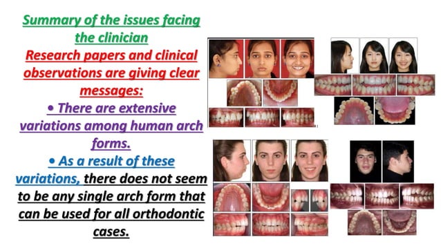 orthodontic arch form | PPTX | Dental Health | Diseases and Conditions