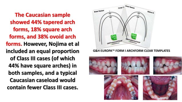 orthodontic arch form | PPTX | Dental Health | Diseases and Conditions
