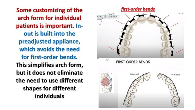 orthodontic arch form | PPTX | Dental Health | Diseases and Conditions