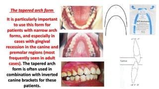 orthodontic arch form | PPTX