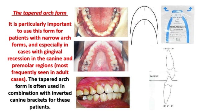 orthodontic arch form | PPTX | Dental Health | Diseases and Conditions