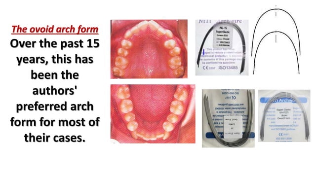 orthodontic arch form | PPTX | Dental Health | Diseases and Conditions
