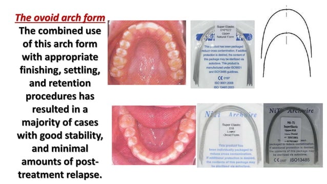 orthodontic arch form | PPTX | Dental Health | Diseases and Conditions