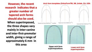 orthodontic arch form | PPTX