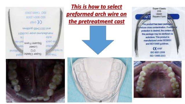 orthodontic arch form | PPTX | Dental Health | Diseases and Conditions