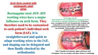 orthodontic arch form | PPTX