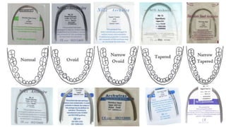 orthodontic arch form | PPTX