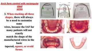 orthodontic arch form | PPTX