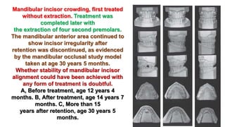 orthodontic arch form | PPTX