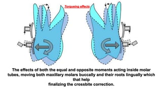 orthodontic arch form | PPTX