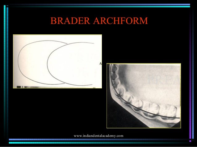Arch forms /certified fixed orthodontic courses by Indian dental acad…