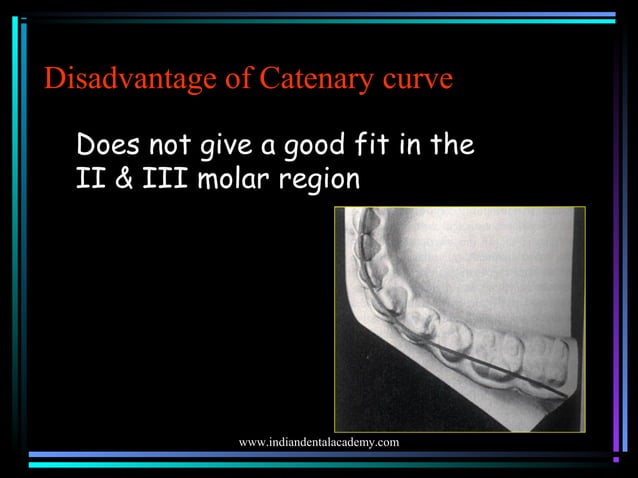 Arch forms | PPT | Dental Health | Diseases and Conditions