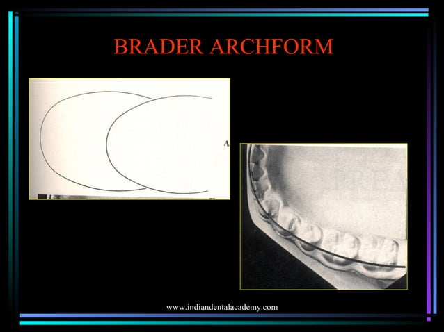 Arch forms | PPT | Dental Health | Diseases and Conditions