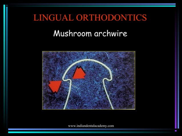 Arch forms | PPT | Dental Health | Diseases and Conditions