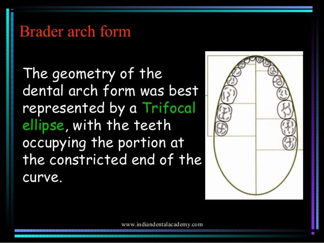 Arch forms