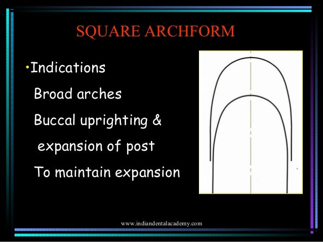 Arch forms