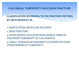 Archilles tendonitis and rupture | PPT