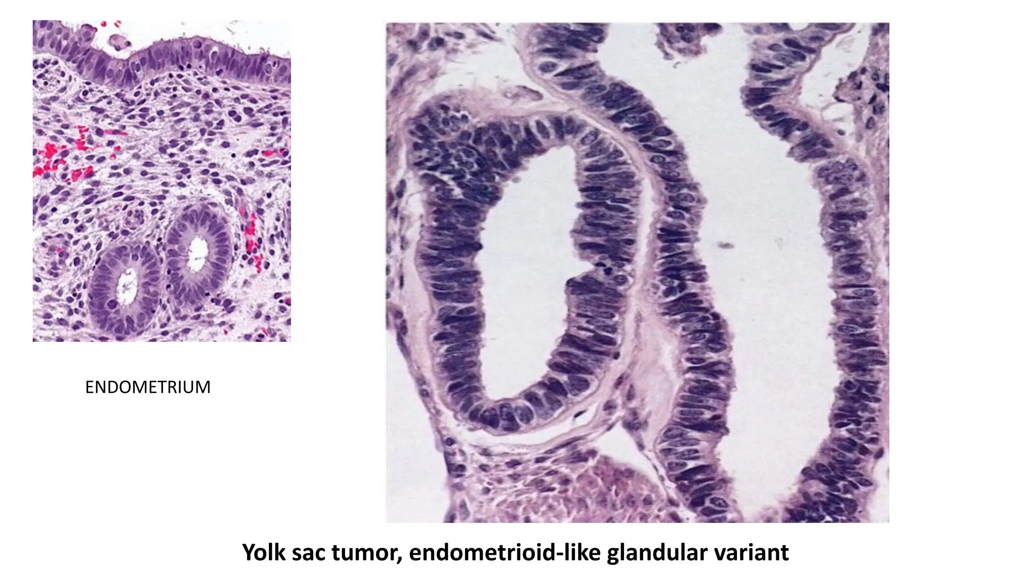 ARCHITECTURAL PATTERNS IN HISTOPATHOLOGY pdf- [Autosaved].pdf