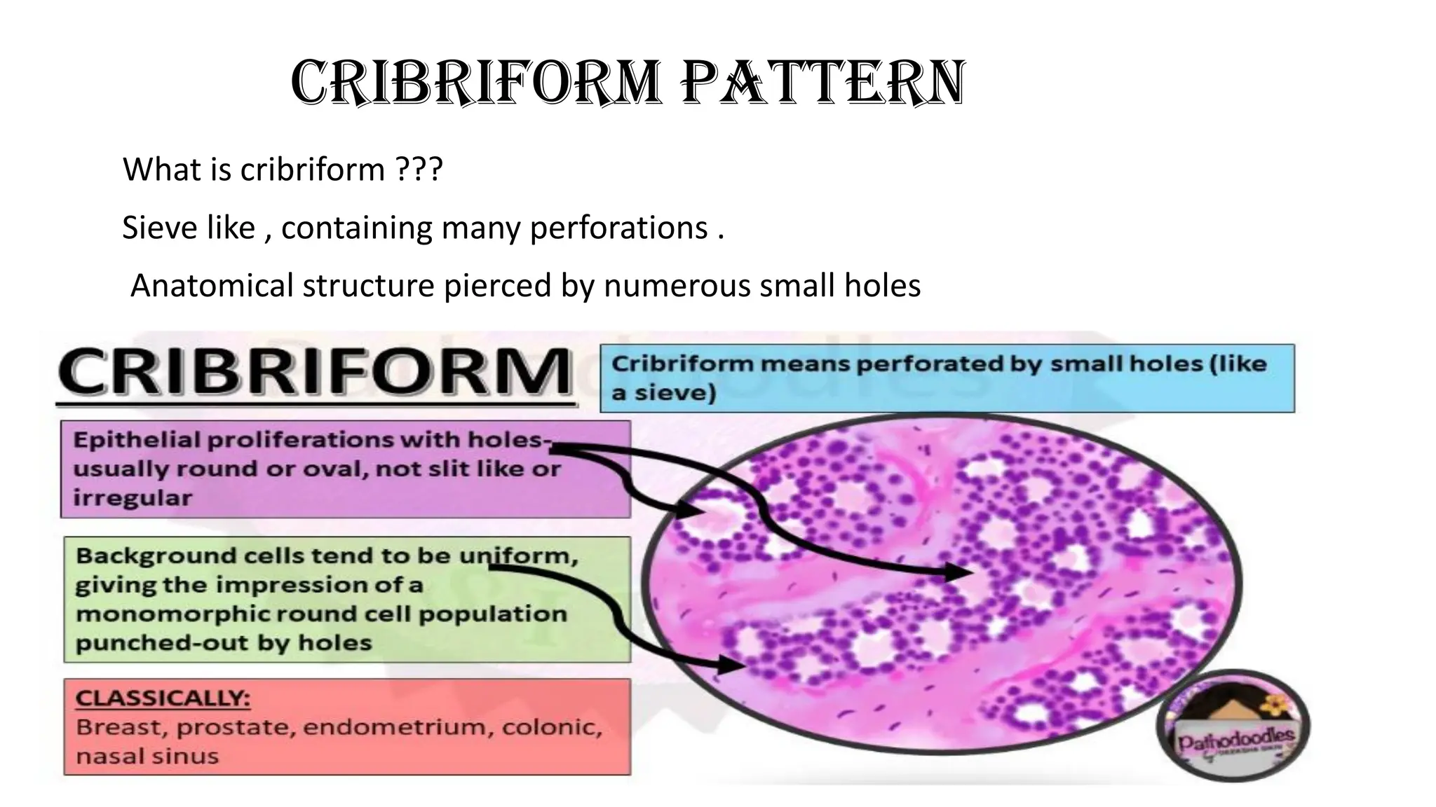 ARCHITECTURAL PATTERNS IN HISTOPATHOLOGY pdf- [Autosaved].pdf