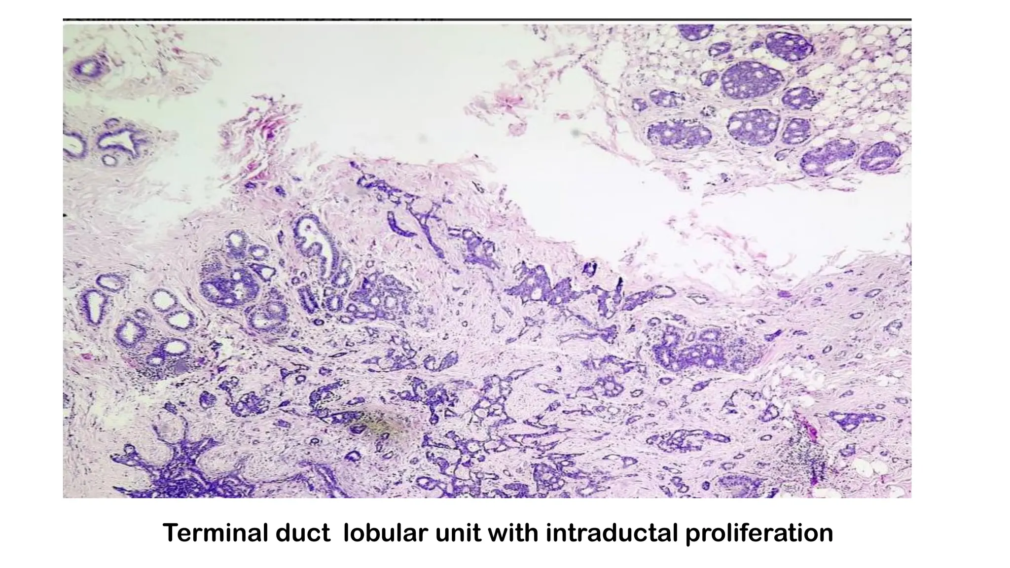 ARCHITECTURAL PATTERNS IN HISTOPATHOLOGY pdf- [Autosaved].pdf