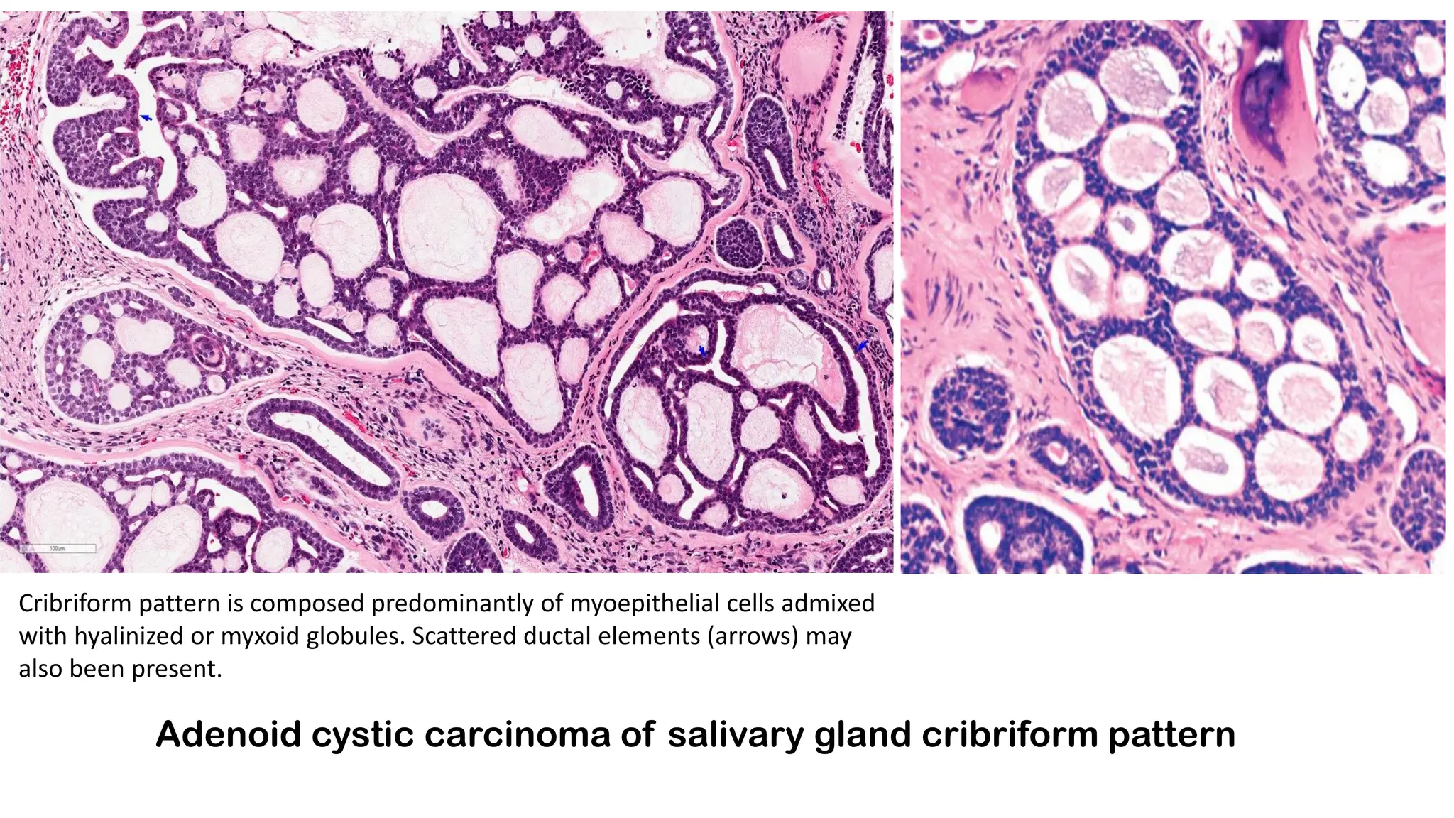 ARCHITECTURAL PATTERNS IN HISTOPATHOLOGY pdf- [Autosaved].pdf