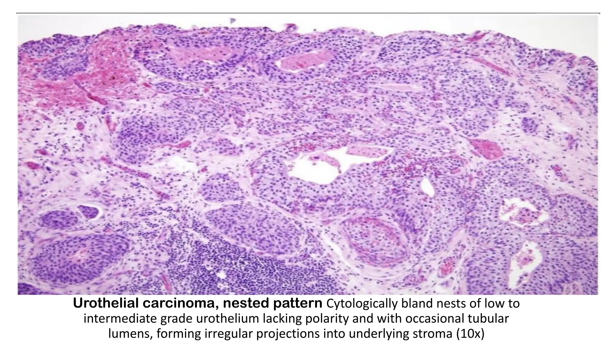 ARCHITECTURAL PATTERNS IN HISTOPATHOLOGY pdf- [Autosaved].pdf
