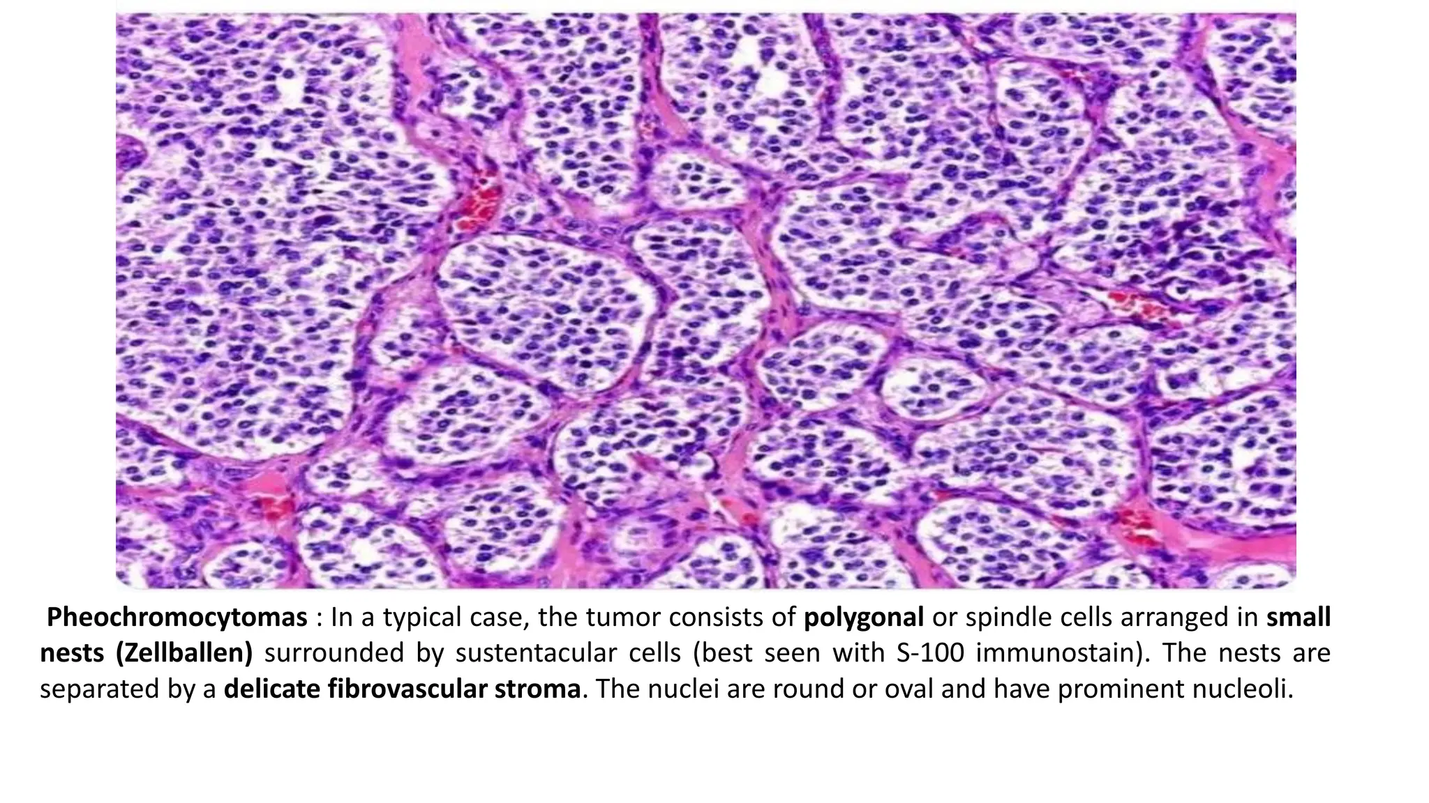 ARCHITECTURAL PATTERNS IN HISTOPATHOLOGY pdf- [Autosaved].pdf