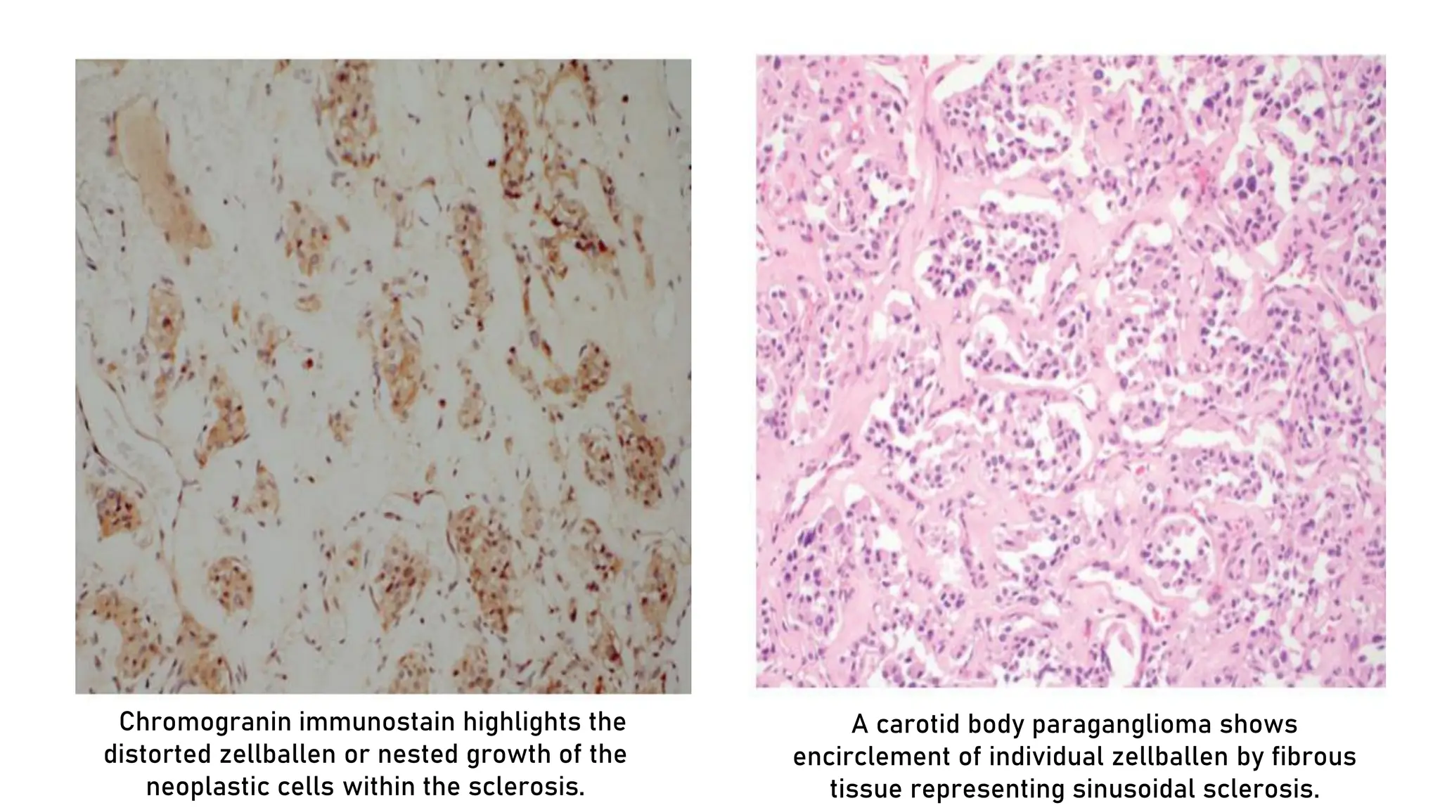 ARCHITECTURAL PATTERNS IN HISTOPATHOLOGY pdf- [Autosaved].pdf