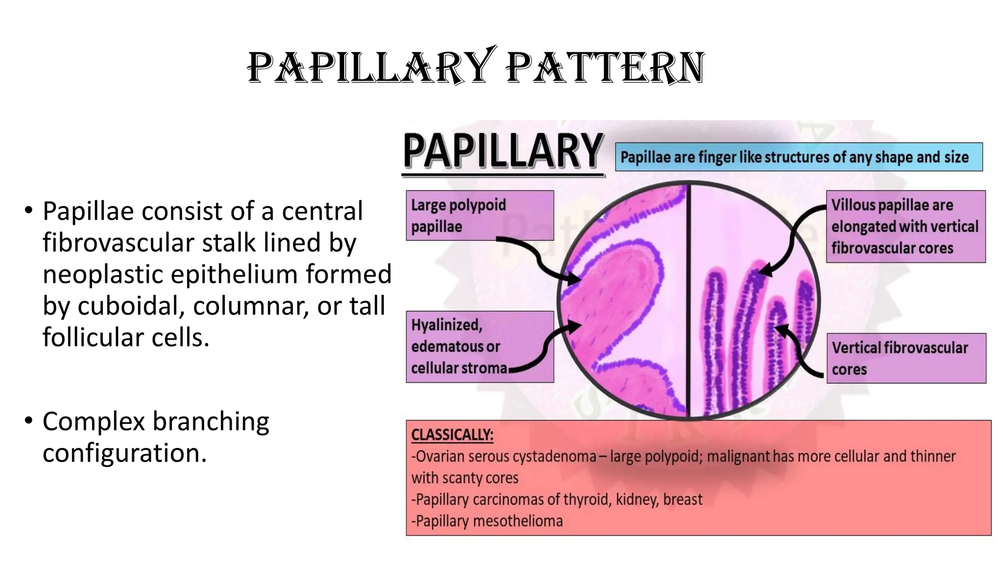 ARCHITECTURAL PATTERNS IN HISTOPATHOLOGY pdf- [Autosaved].pdf