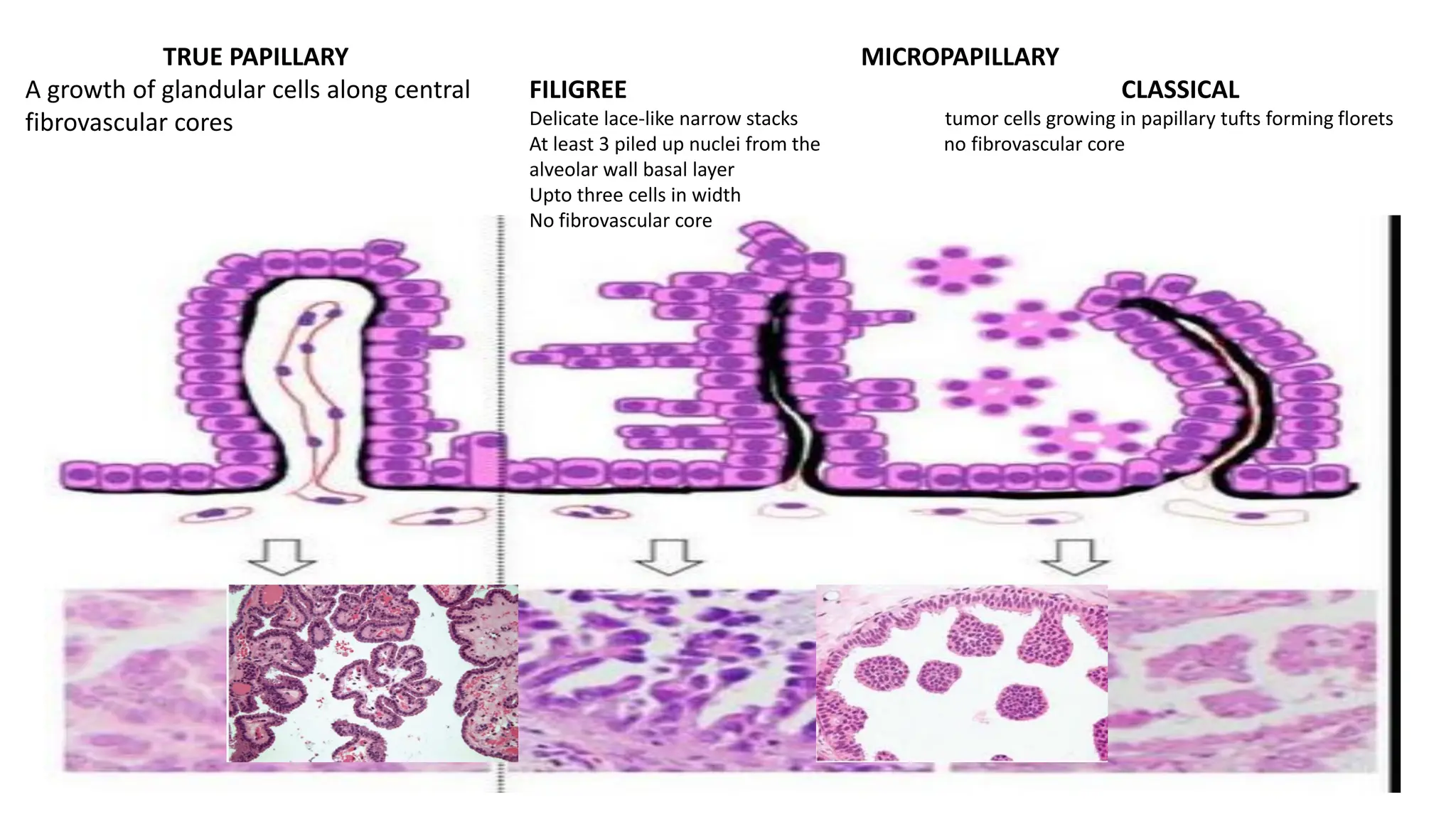 ARCHITECTURAL PATTERNS IN HISTOPATHOLOGY pdf- [Autosaved].pdf