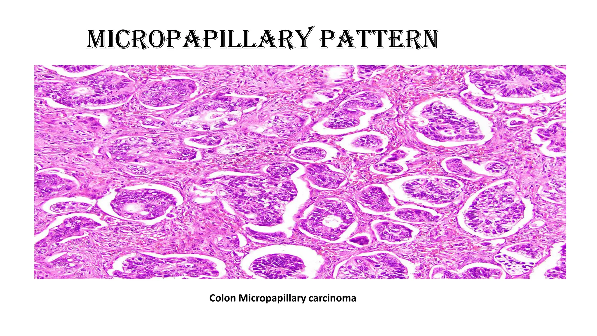 ARCHITECTURAL PATTERNS IN HISTOPATHOLOGY pdf- [Autosaved].pdf