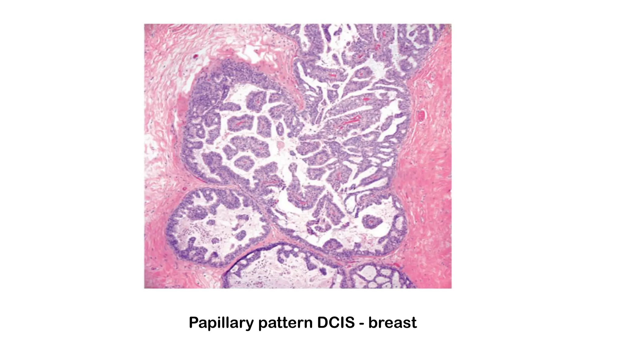 ARCHITECTURAL PATTERNS IN HISTOPATHOLOGY pdf- [Autosaved].pdf