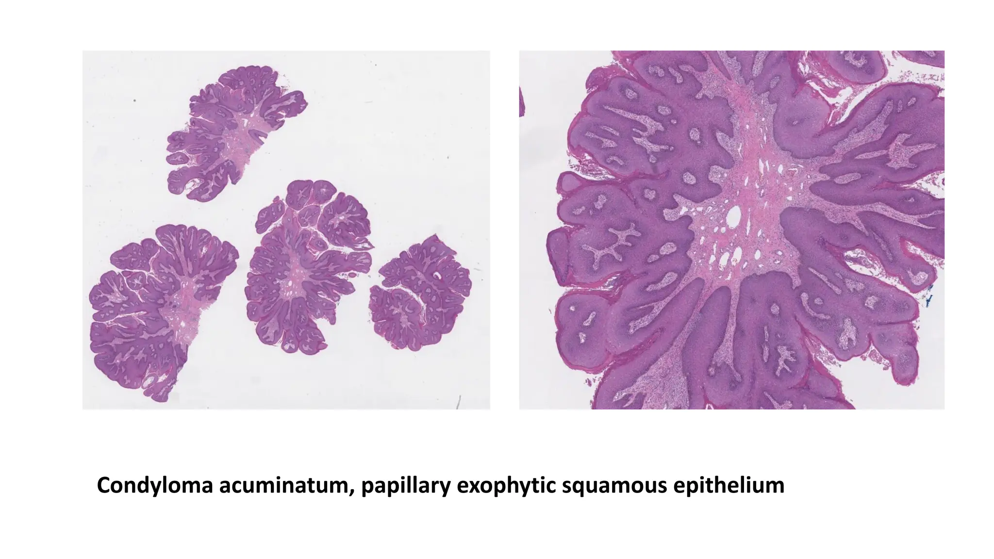 ARCHITECTURAL PATTERNS IN HISTOPATHOLOGY pdf- [Autosaved].pdf