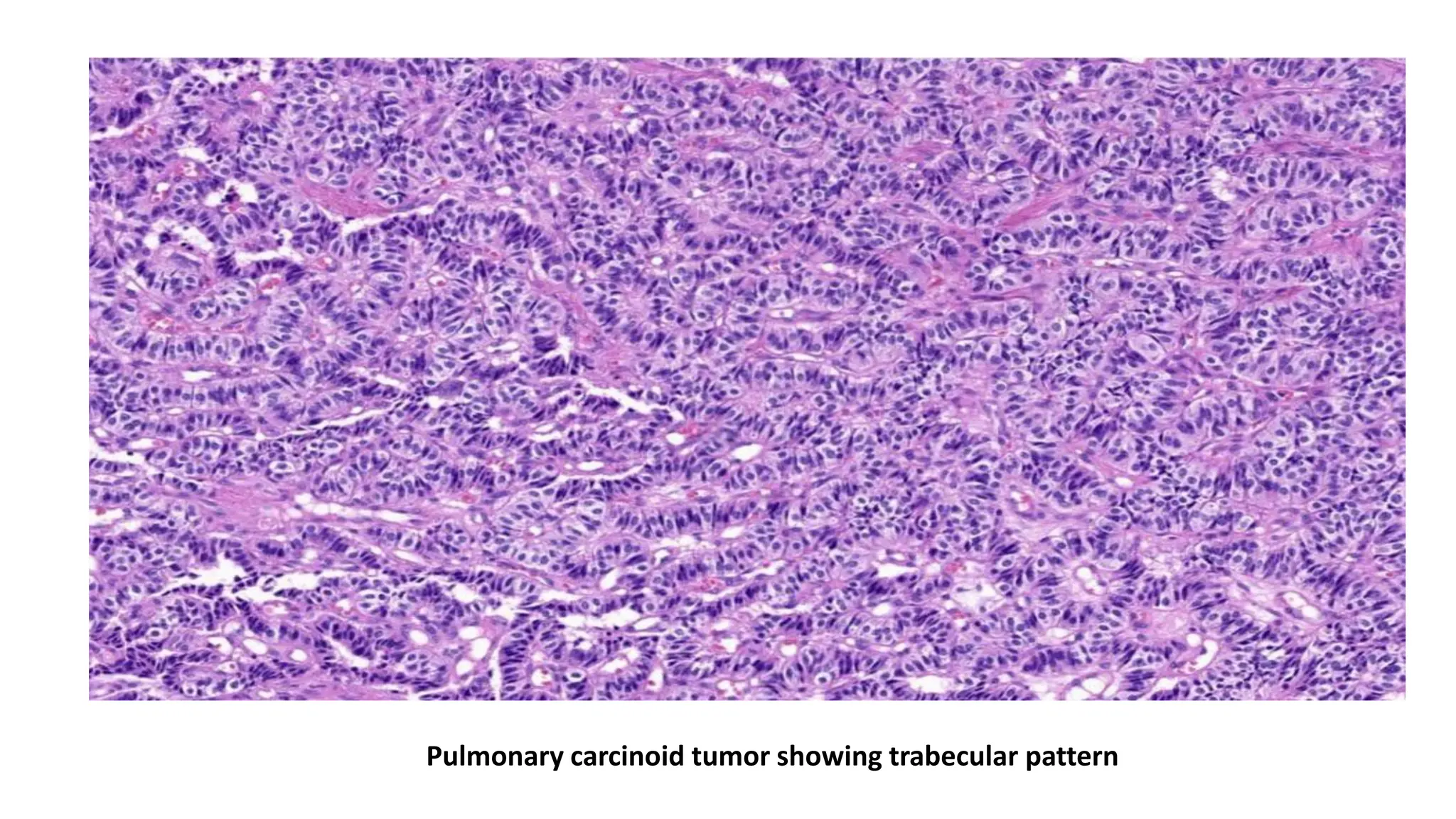 ARCHITECTURAL PATTERNS IN HISTOPATHOLOGY pdf- [Autosaved].pdf