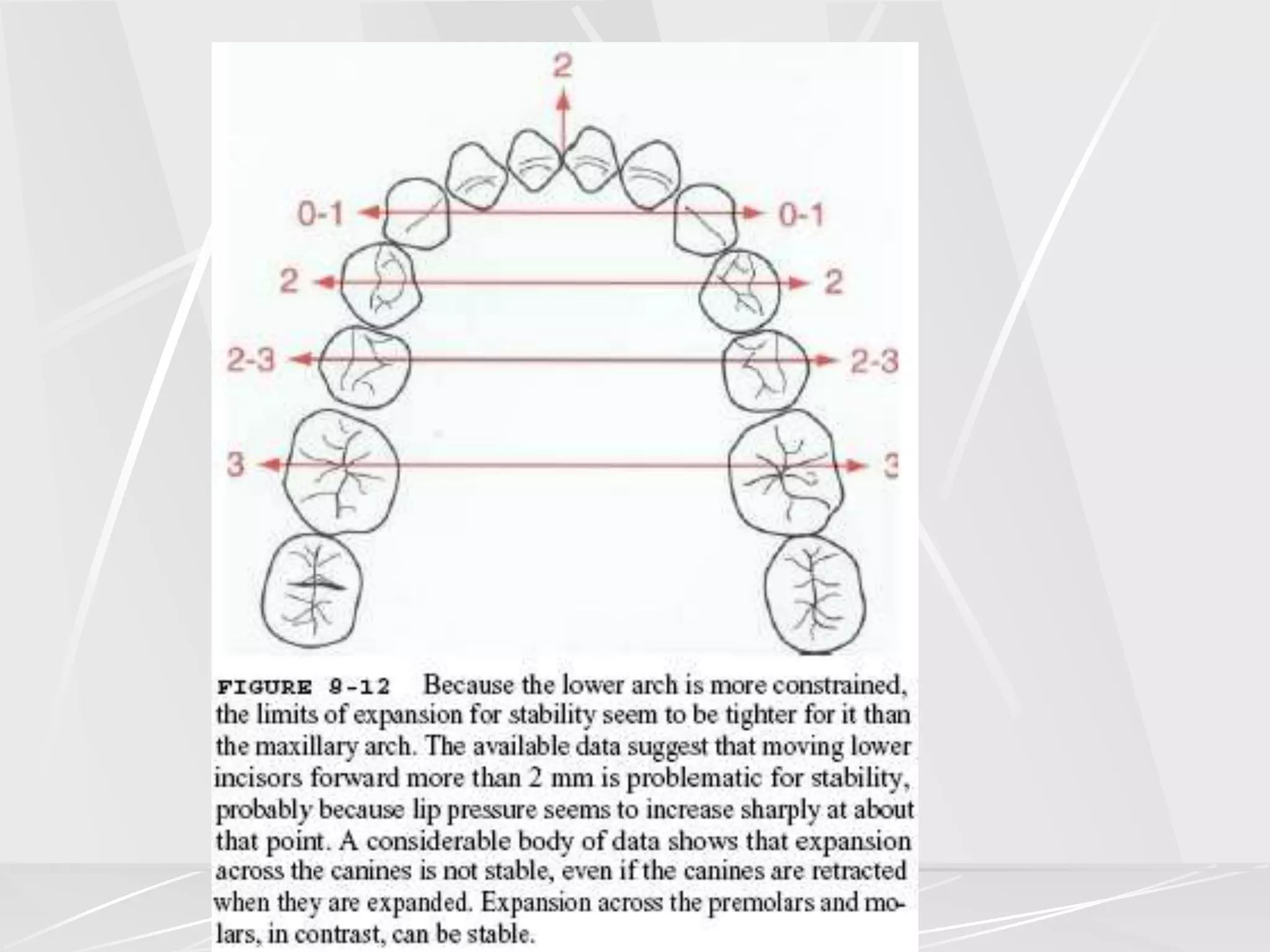 Arch lengthening and expansion.ppt
