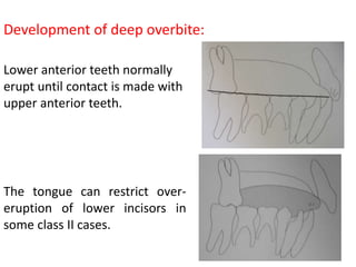 Arch leveling & overbite control | PPTX | Dental Health | Diseases and ...