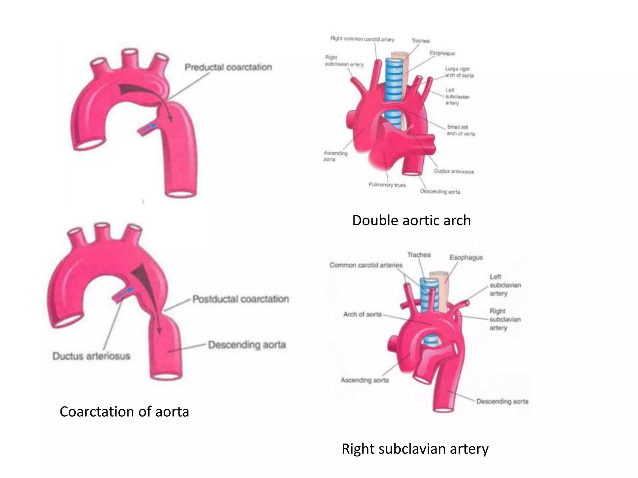 Arch of aorta | PPTX