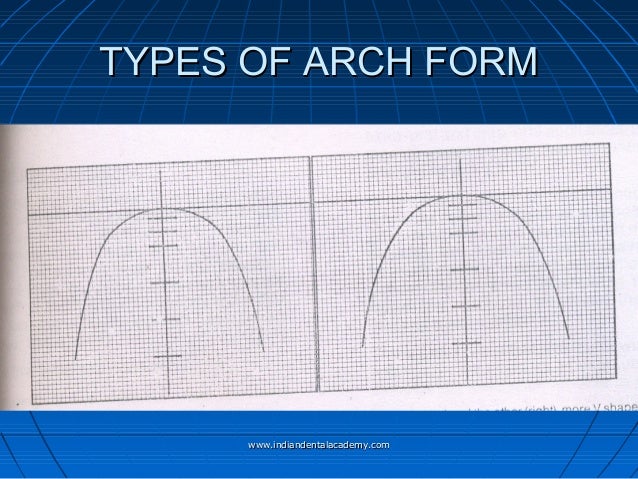 Arch Form in orthodontics /certified fixed orthodontic courses by Ind…