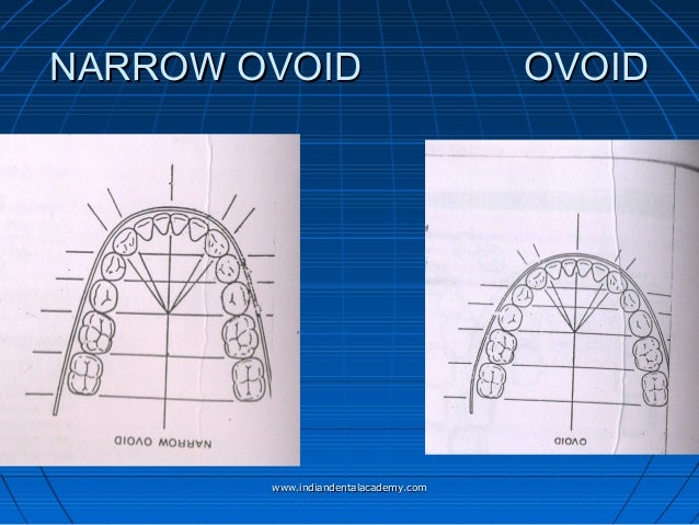 Arch Form in orthodontics /certified fixed orthodontic courses by Ind…
