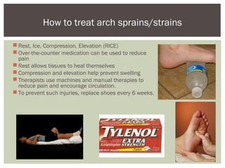 Arch sprains | PPT