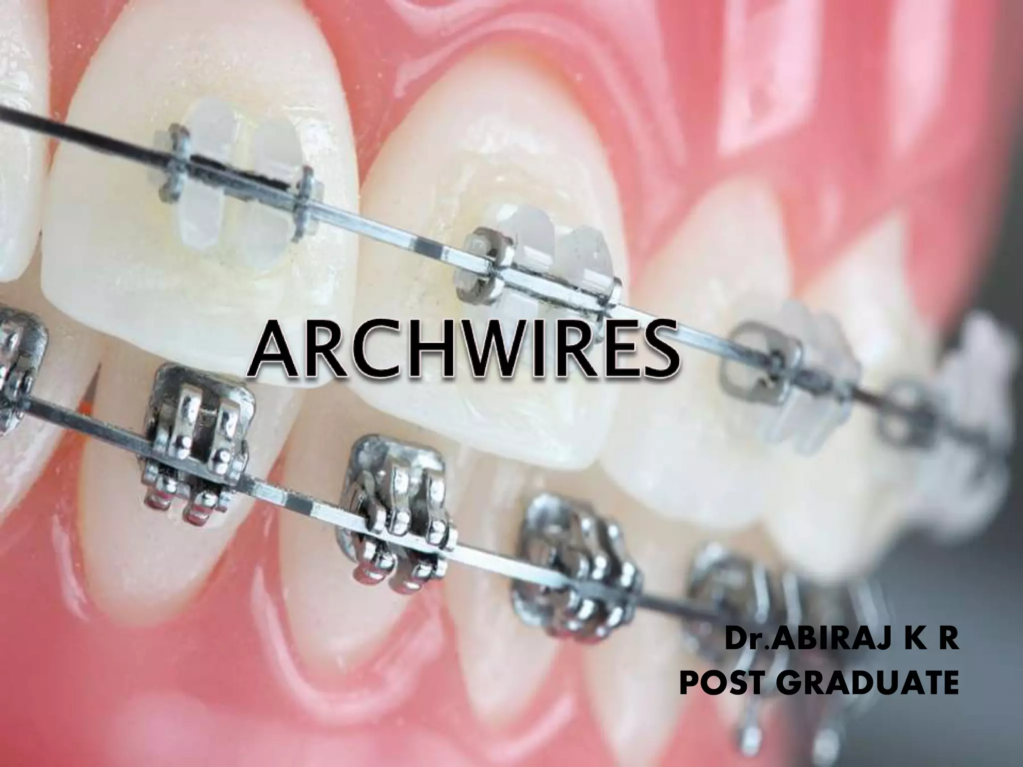 Archwires in orthodontics | PPTX