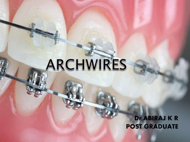 Archwires in orthodontics | PPTX