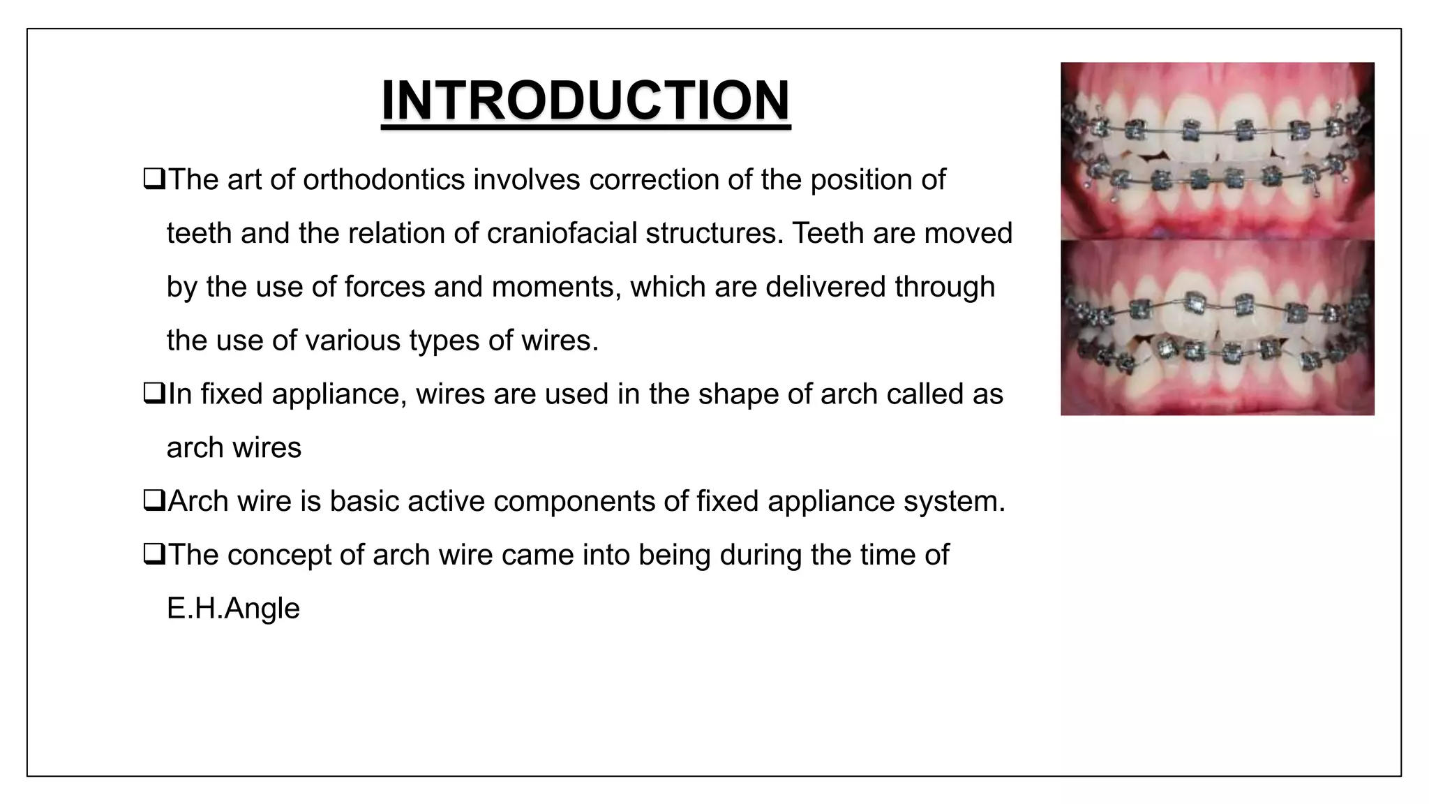 Archwires In Orthodontics.pptx