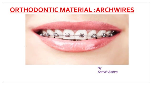 Archwires In Orthodontics.pptx | Physics | Science
